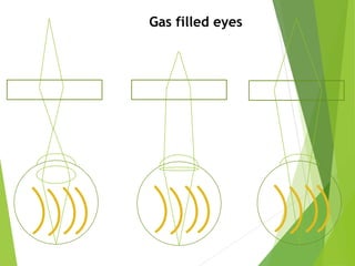 Special_scenario for indirect ophthalmology.pptx | Eye and Vision ...