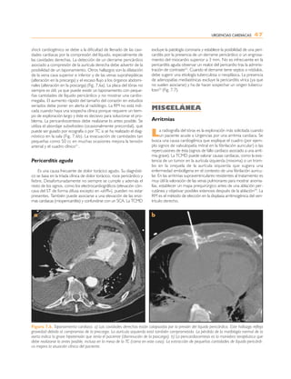 Urgencias radiologicas_Radiologia_en_Urgencias_-_seram.pdf