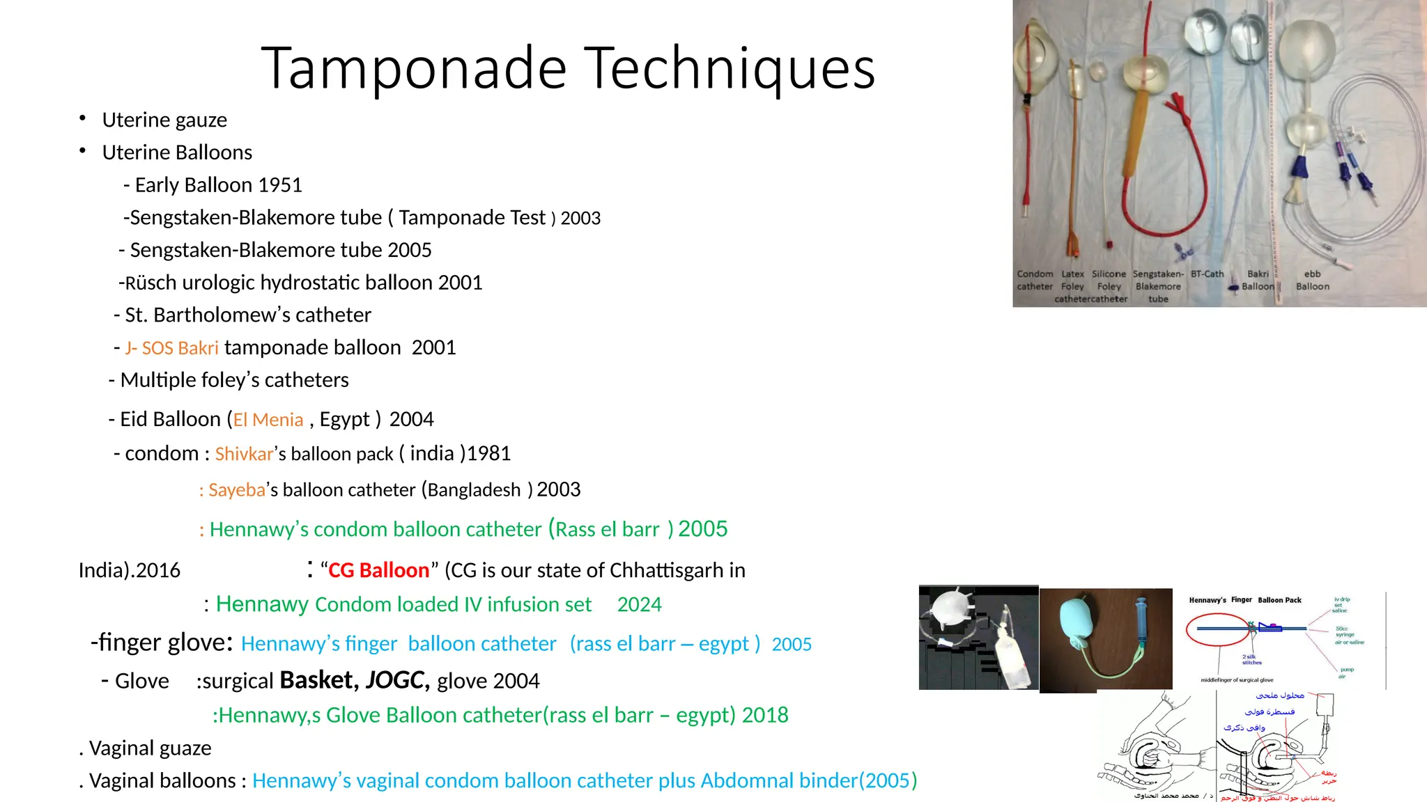 3 Hennawy Handemade ( IUTB) intrauterine balloons tamonade.ppsx ...