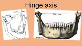 hinge axis | PPTX
