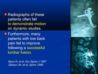 Dynamic Stabilization in the Surgical Management of Painful Lumbar ...