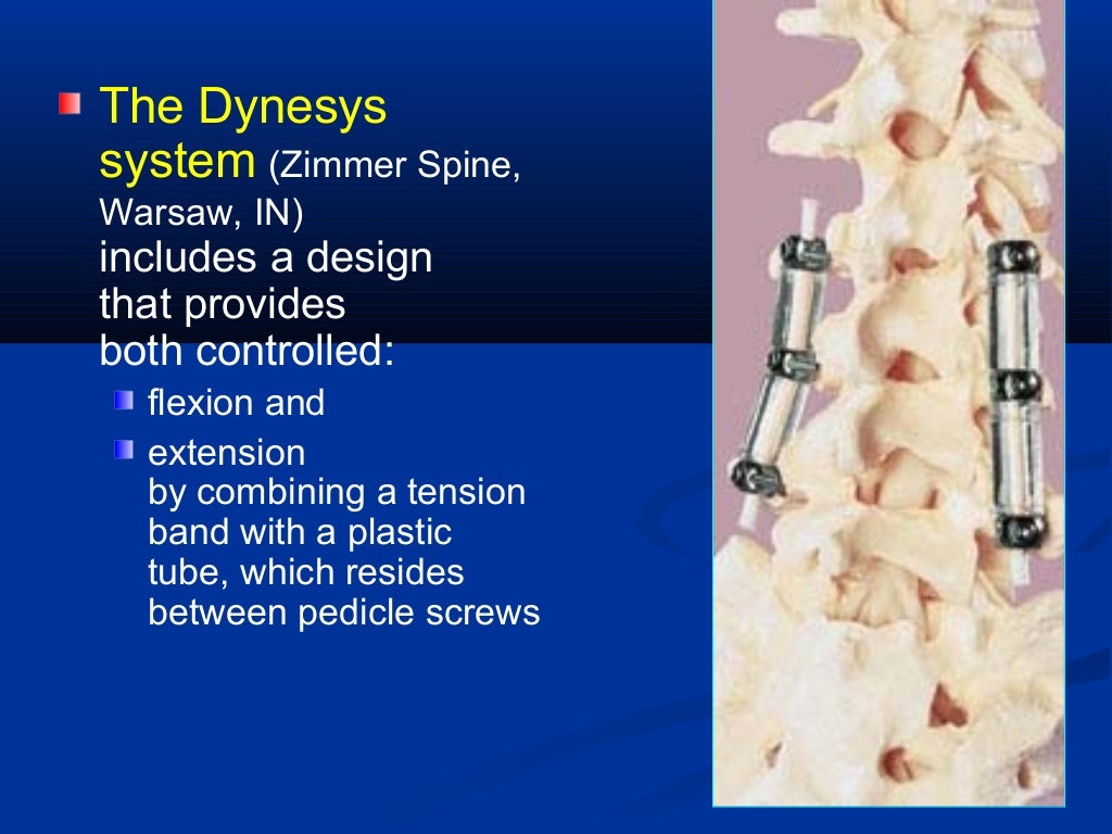 Dynamic Stabilization in the Surgical Management of Painful Lumbar Sp…