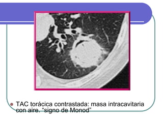 3 hongos filamentosos productores de micosis oportunistas | PDF