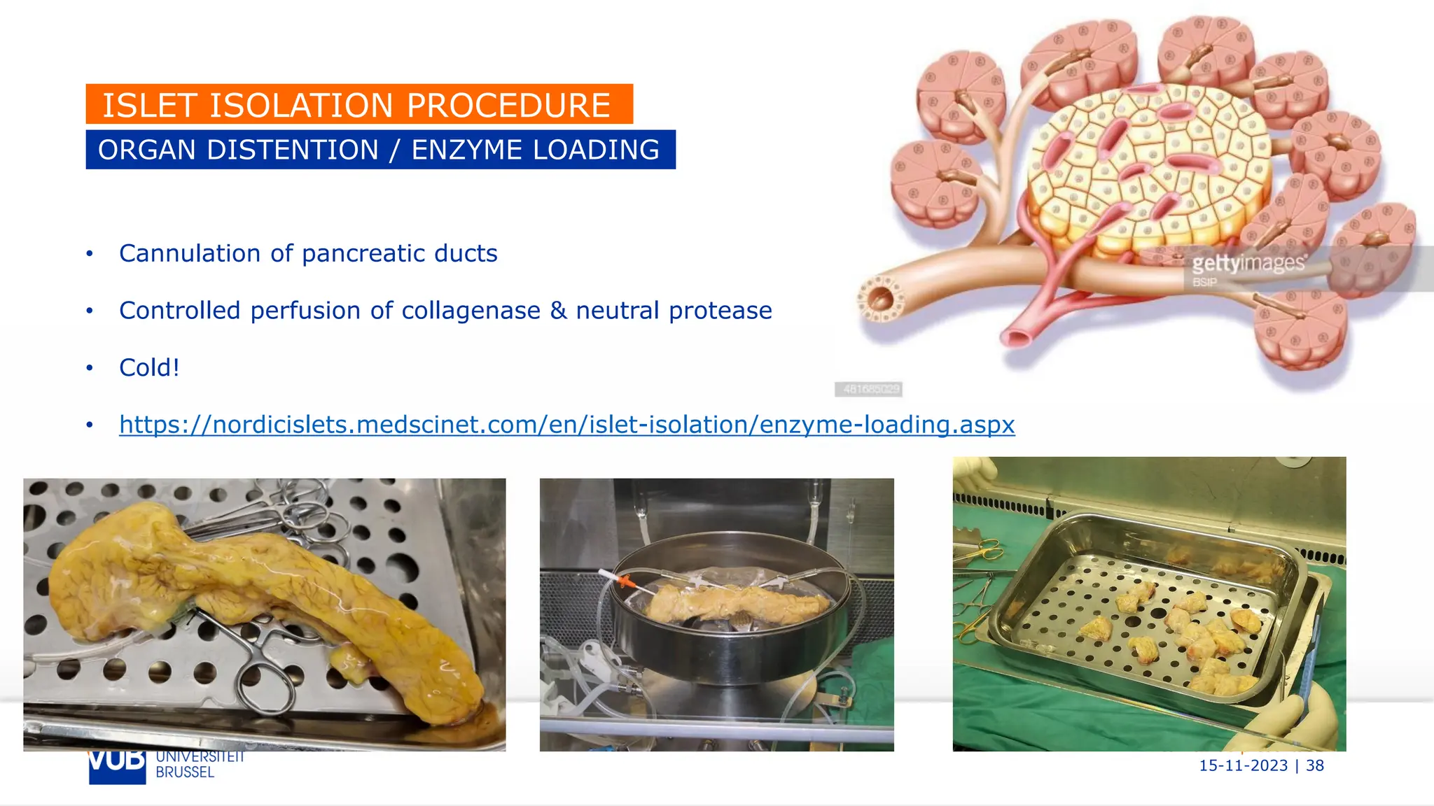 Human beta cell grafts from donors and donors alternative sources for ...
