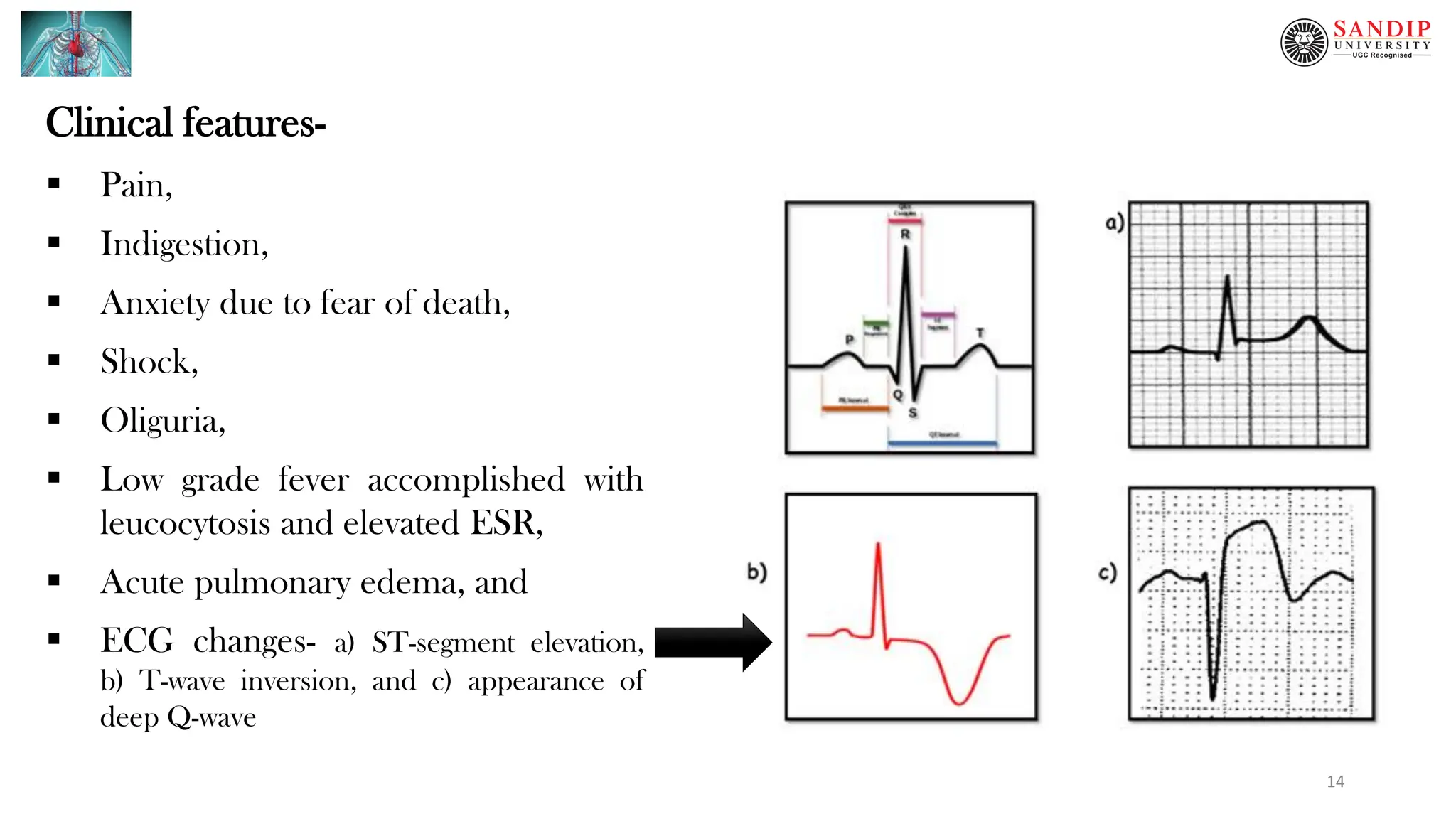 Cardiovascular Pathophysiology- Coronary Artery Disease (CAD)/Ischaemic ...