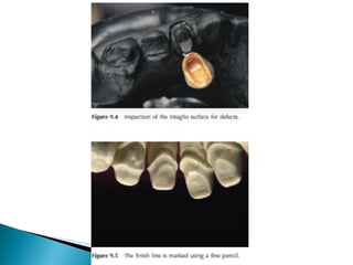 3 impression techniques and temporization.ppt