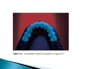 3 impression techniques and temporization.ppt