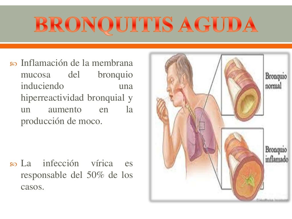 Infección De Vías Respiratorias Bajas
