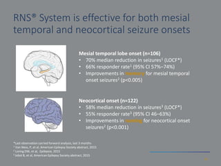 Responsive Neurostimulation (RNS) for Intractable Epilepsy | PPTX
