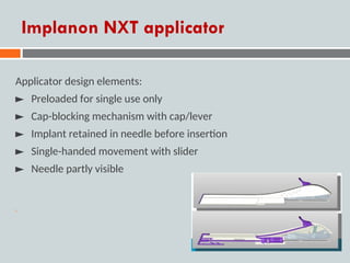 3 insertion and removal of implanon ppt | PPT