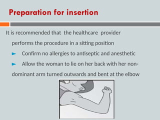 3 insertion and removal of implanon ppt | PPT