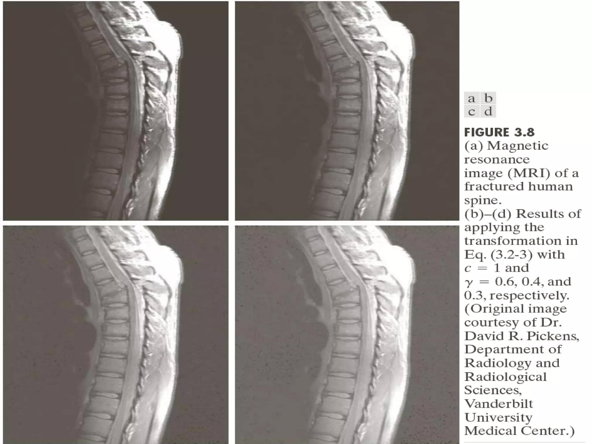 3 Intensity Transformations And Spatial Filtering Slides Ppt