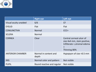 case_presentation_on_corneal_ulcer__123.pptx