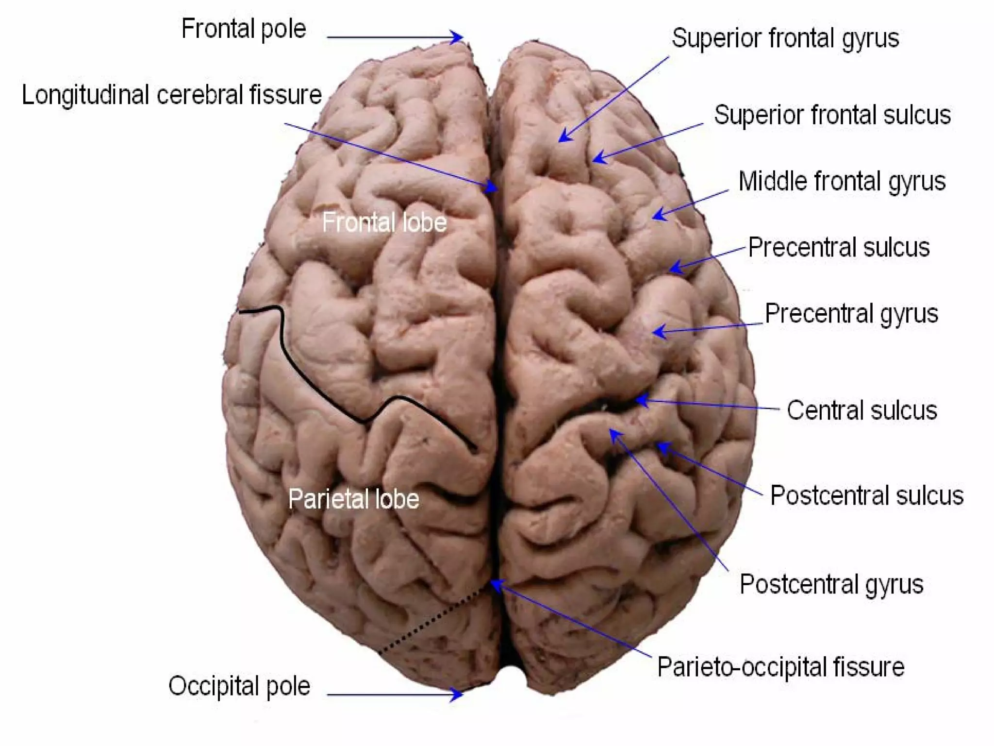 Anatomy of the Cerebrum | PPT