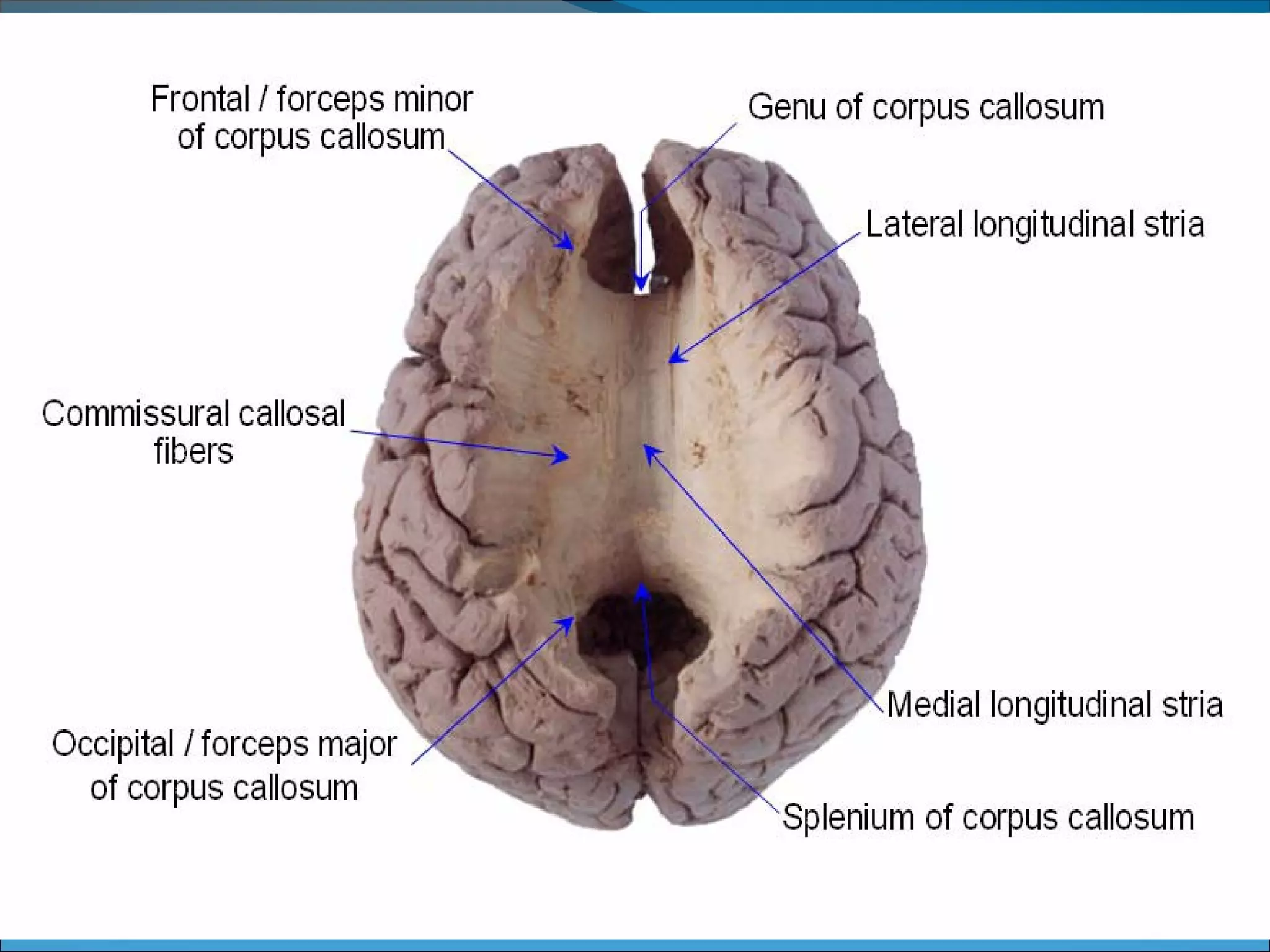Anatomy of the Cerebrum | PPT