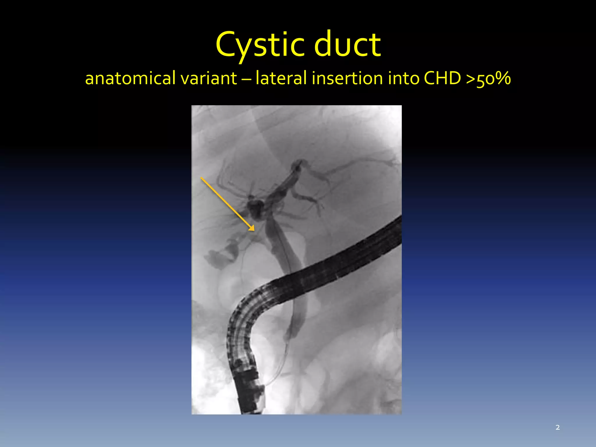The cystic duct and Callot triangle: important educational reminder ...
