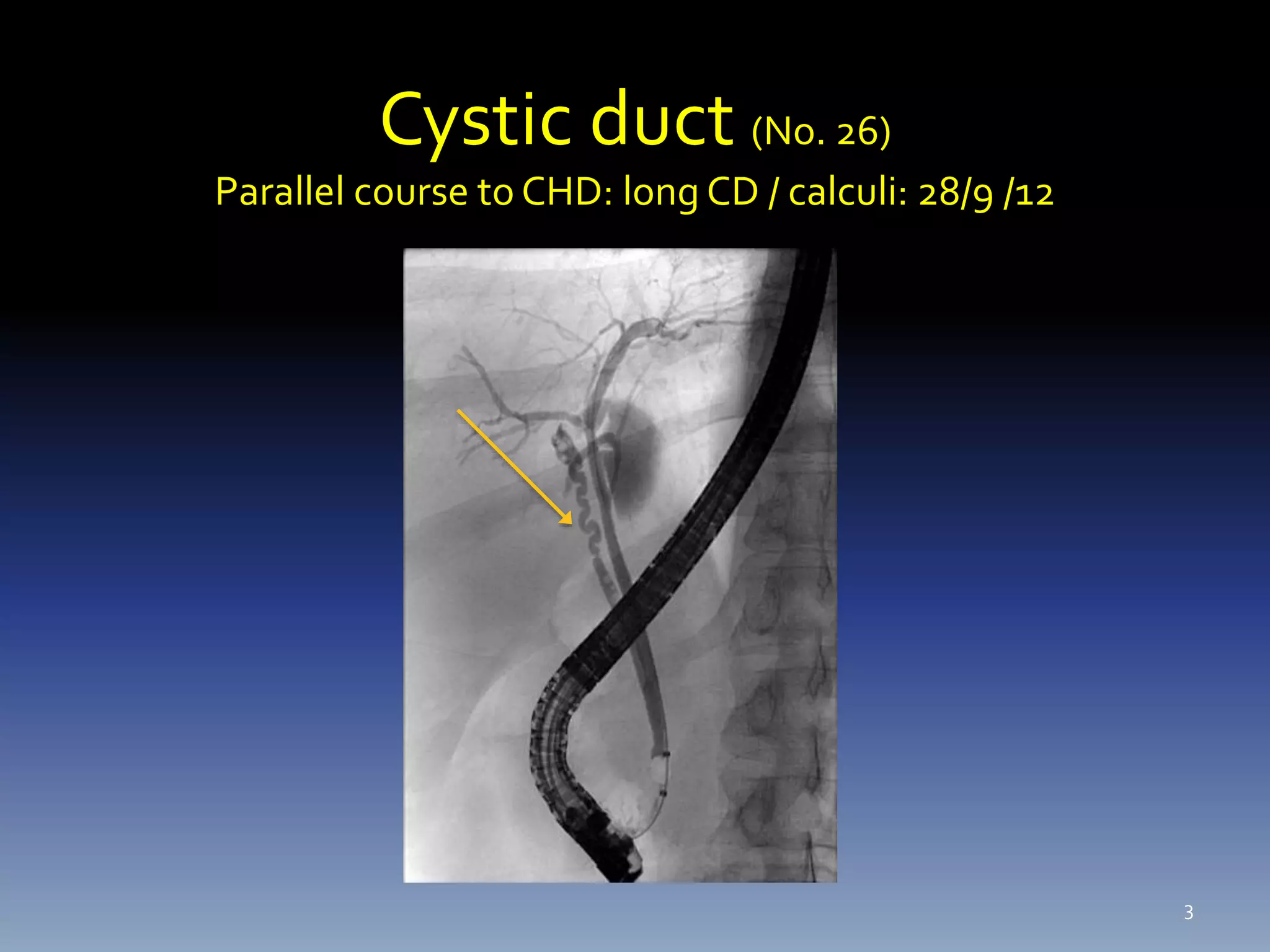 The cystic duct and Callot triangle: important educational reminder ...