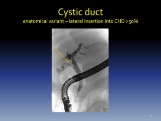 The cystic duct and Callot triangle: important educational reminder ...