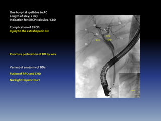 The cystic duct and Callot triangle: important educational reminder ...