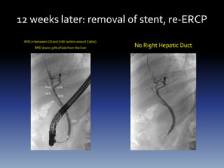 The cystic duct and Callot triangle: important educational reminder ...