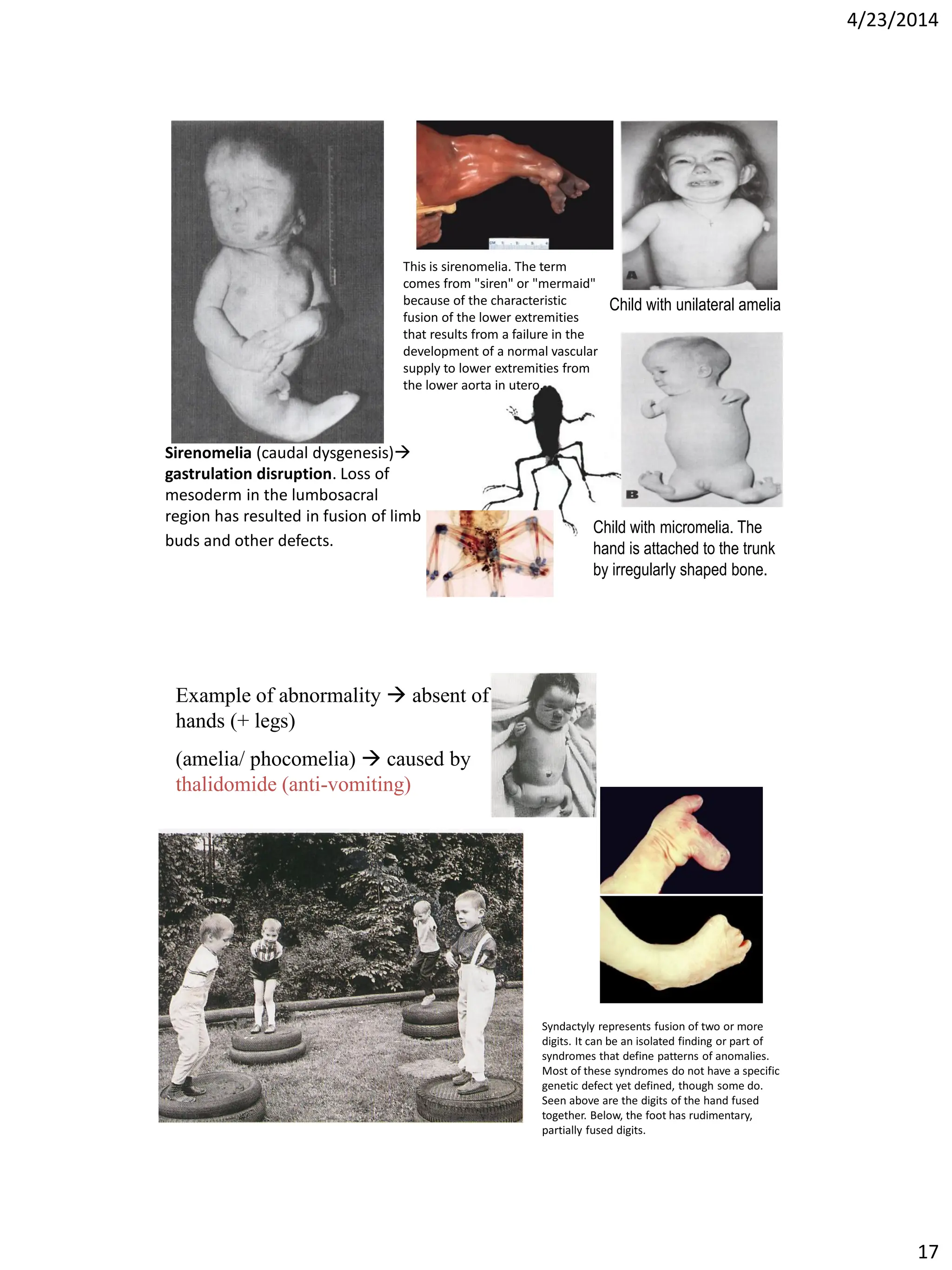 Turunan-mesoderm-urogenital-limb-2014.pdf