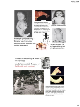 Turunan-mesoderm-urogenital-limb-2014.pdf