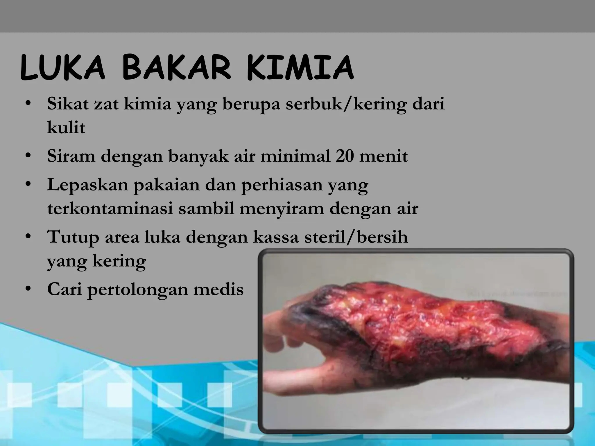 3 Luka Bakar.pptx dan penanganan yang bisa dilakukan | PPTX