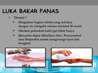 3 Luka Bakar.pptx dan penanganan yang bisa dilakukan | PPTX