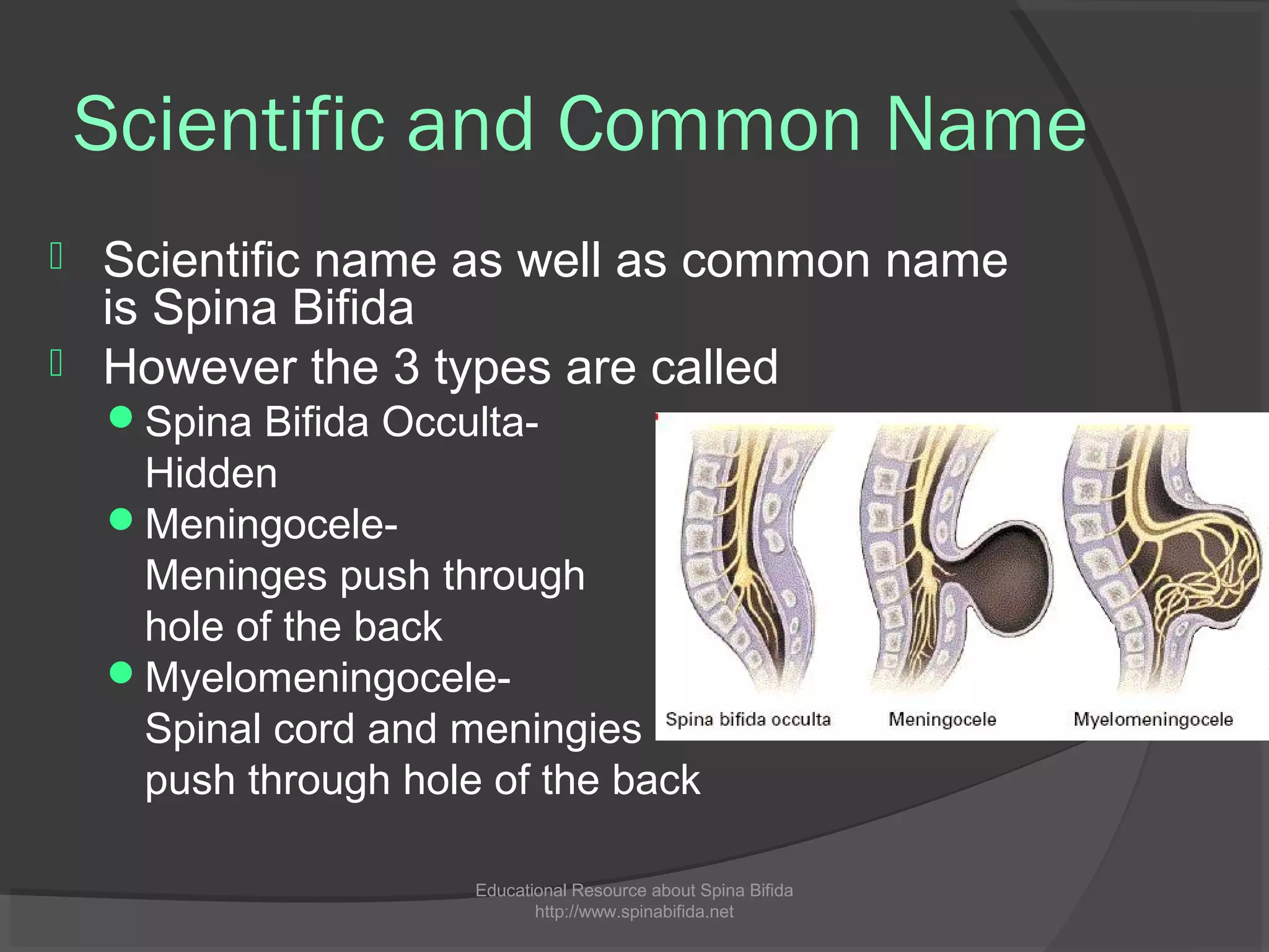 3 Major Issues With Prenatal And Postnatal Spina Bifida Surgery Ppt