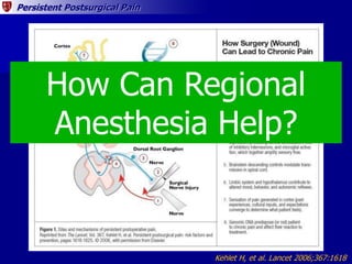 Regional Anesthesia in the Prevention of Persistent Postsurgical Pain ...