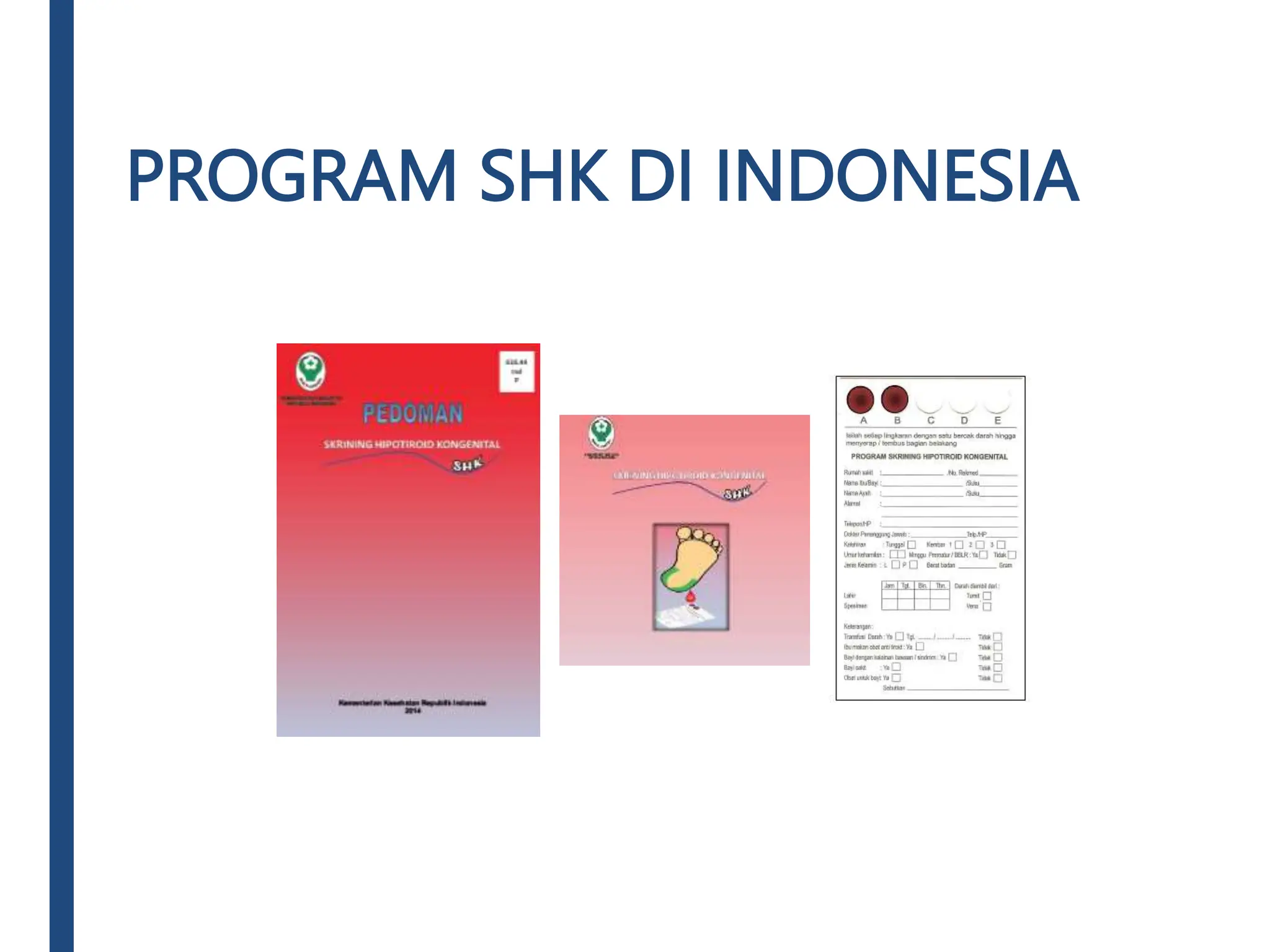 Slide tentang Skrining Hipotiroid Kongenital SHK.pptx