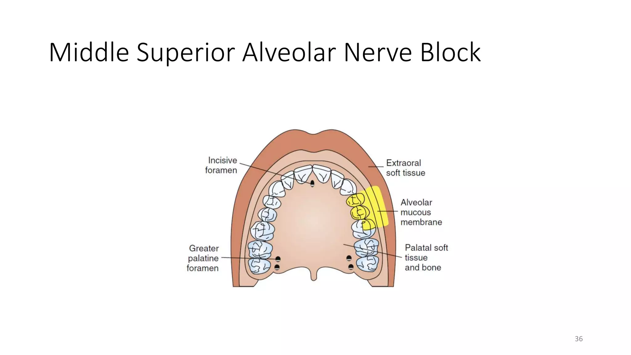 3 MAXILLARY NERVE BLOCKS seminar 3.pptx