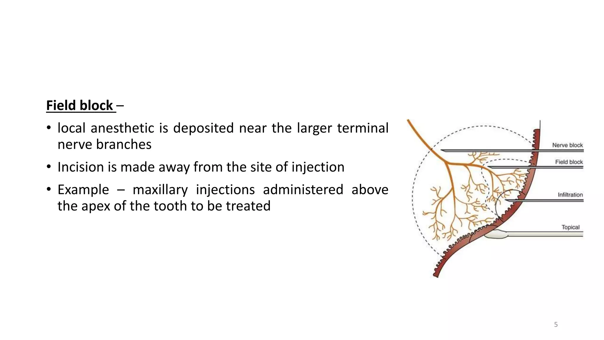 3 MAXILLARY NERVE BLOCKS seminar 3.pptx