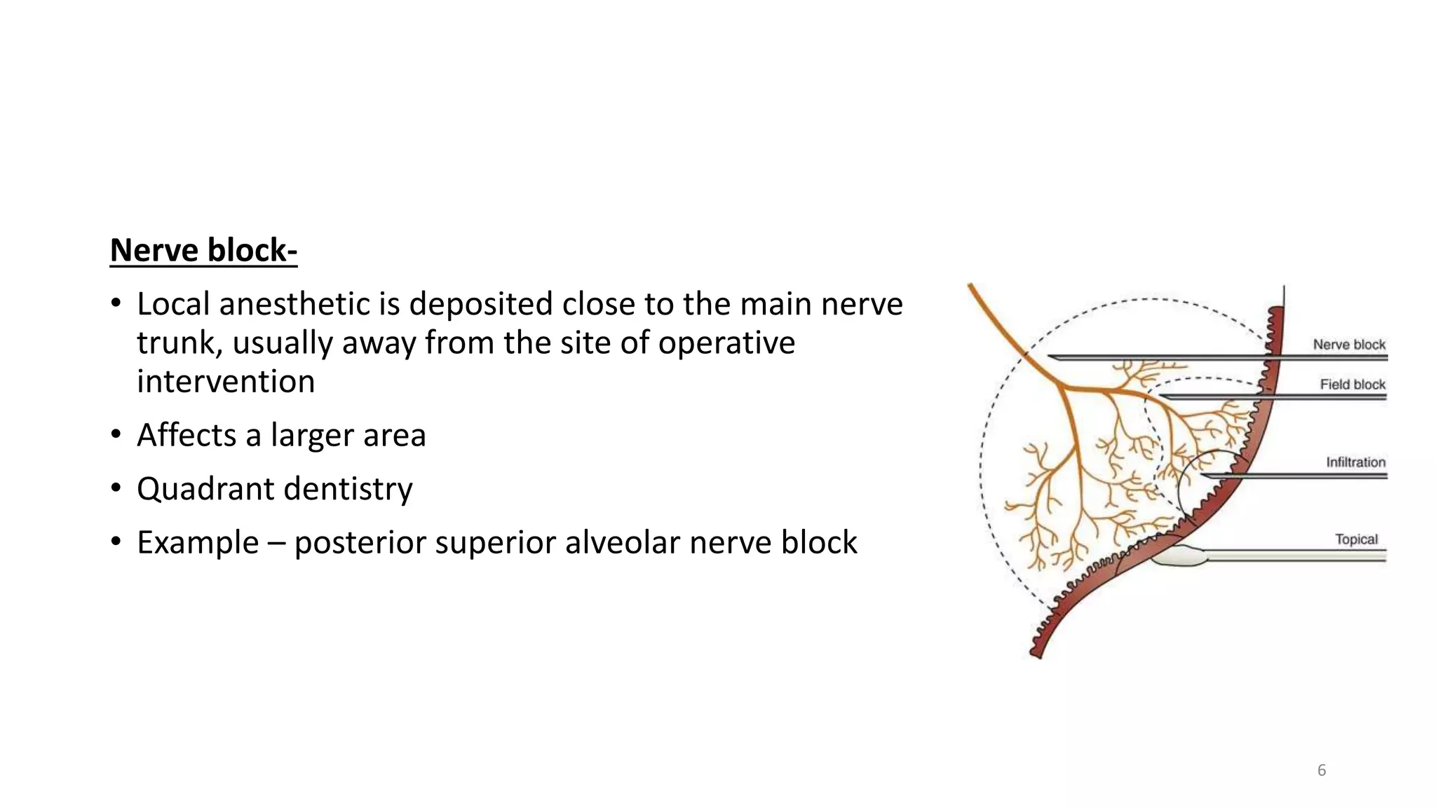 3 MAXILLARY NERVE BLOCKS seminar 3.pptx