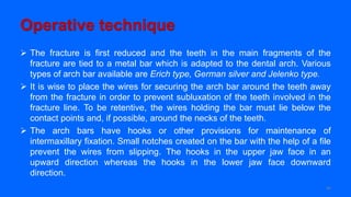 Lecture 3 maxillofacial trauma part 3 | PPTX
