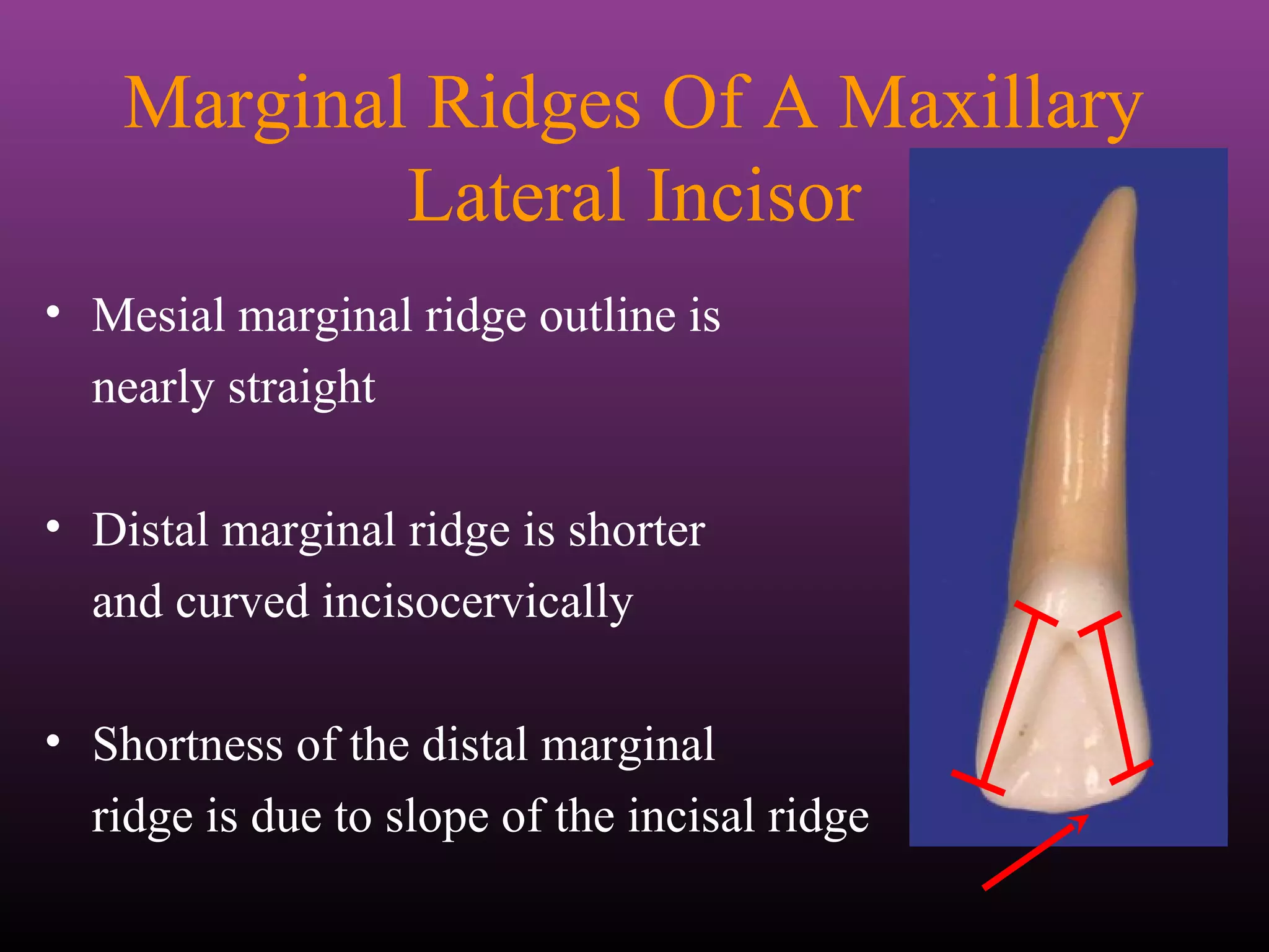 Maxillary Lateral and Mandibular Incisors | PPT