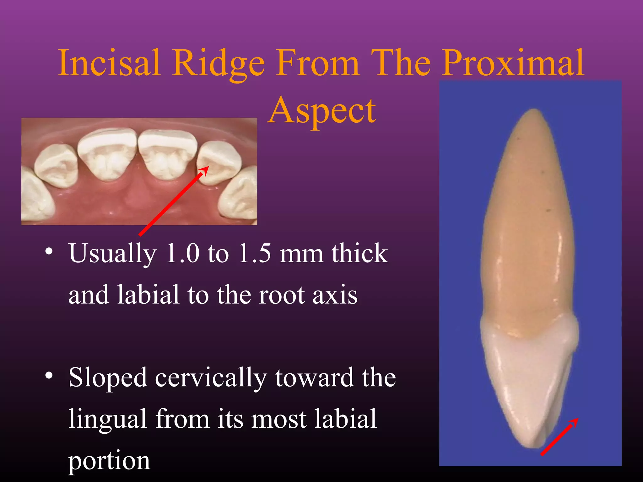 Maxillary Lateral and Mandibular Incisors | PPT