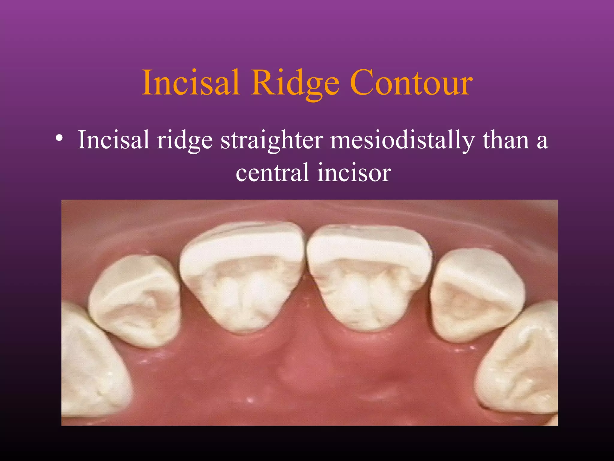 Maxillary Lateral and Mandibular Incisors | PPT