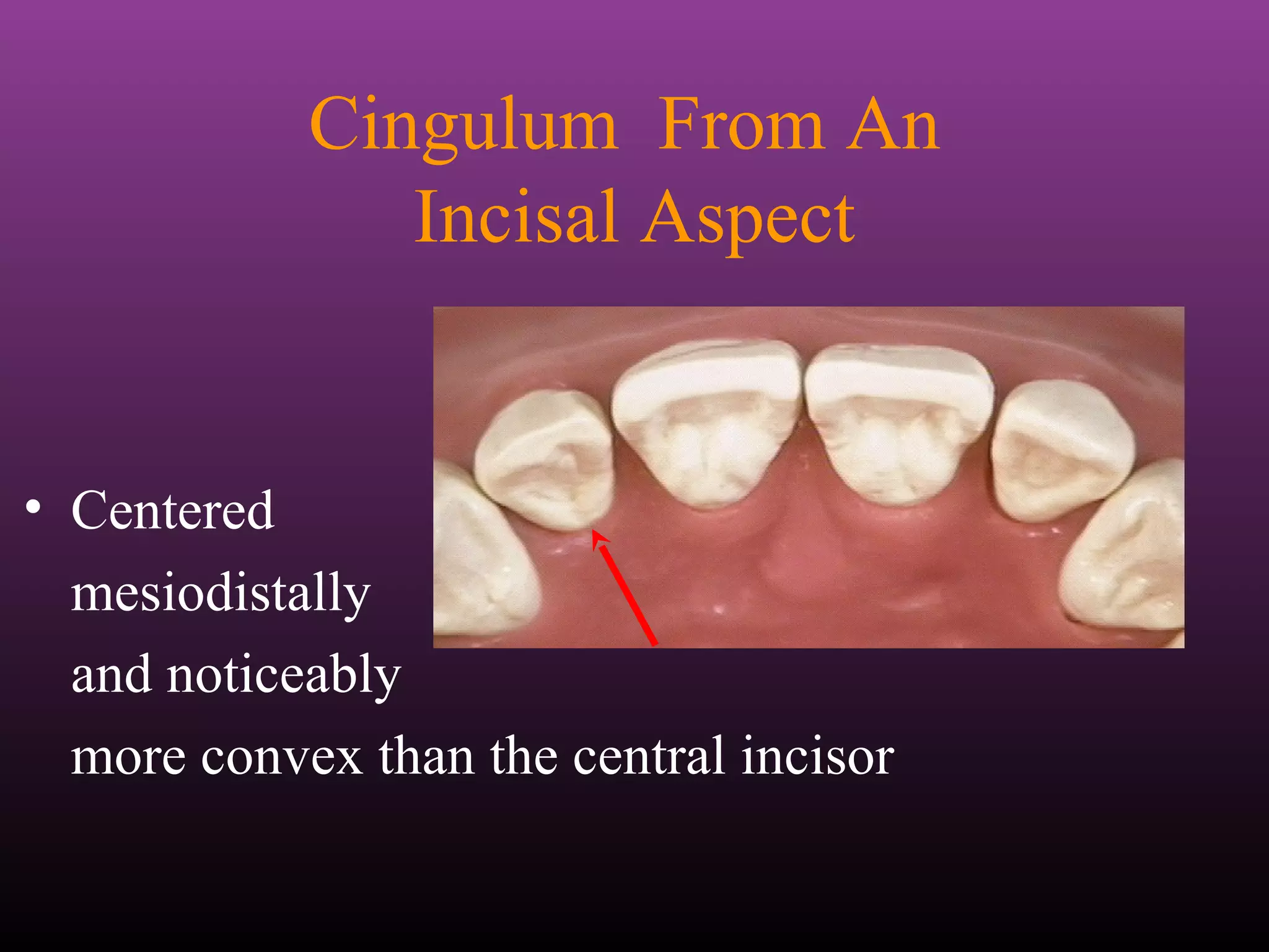 Maxillary Lateral and Mandibular Incisors | PPT
