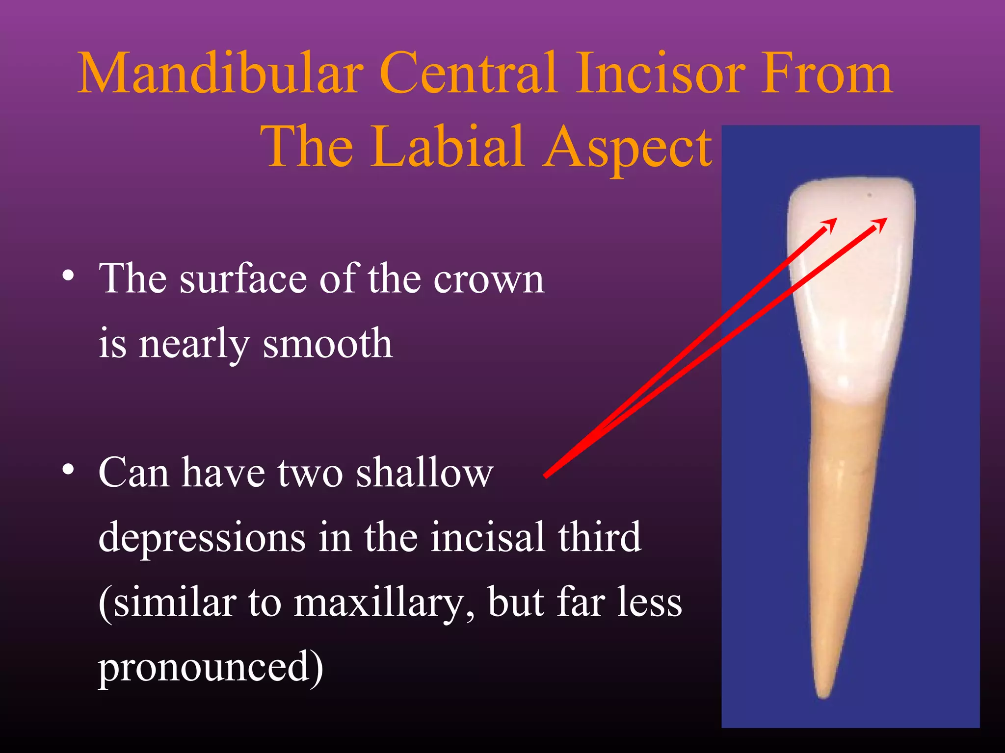 Maxillary Lateral and Mandibular Incisors | PPT