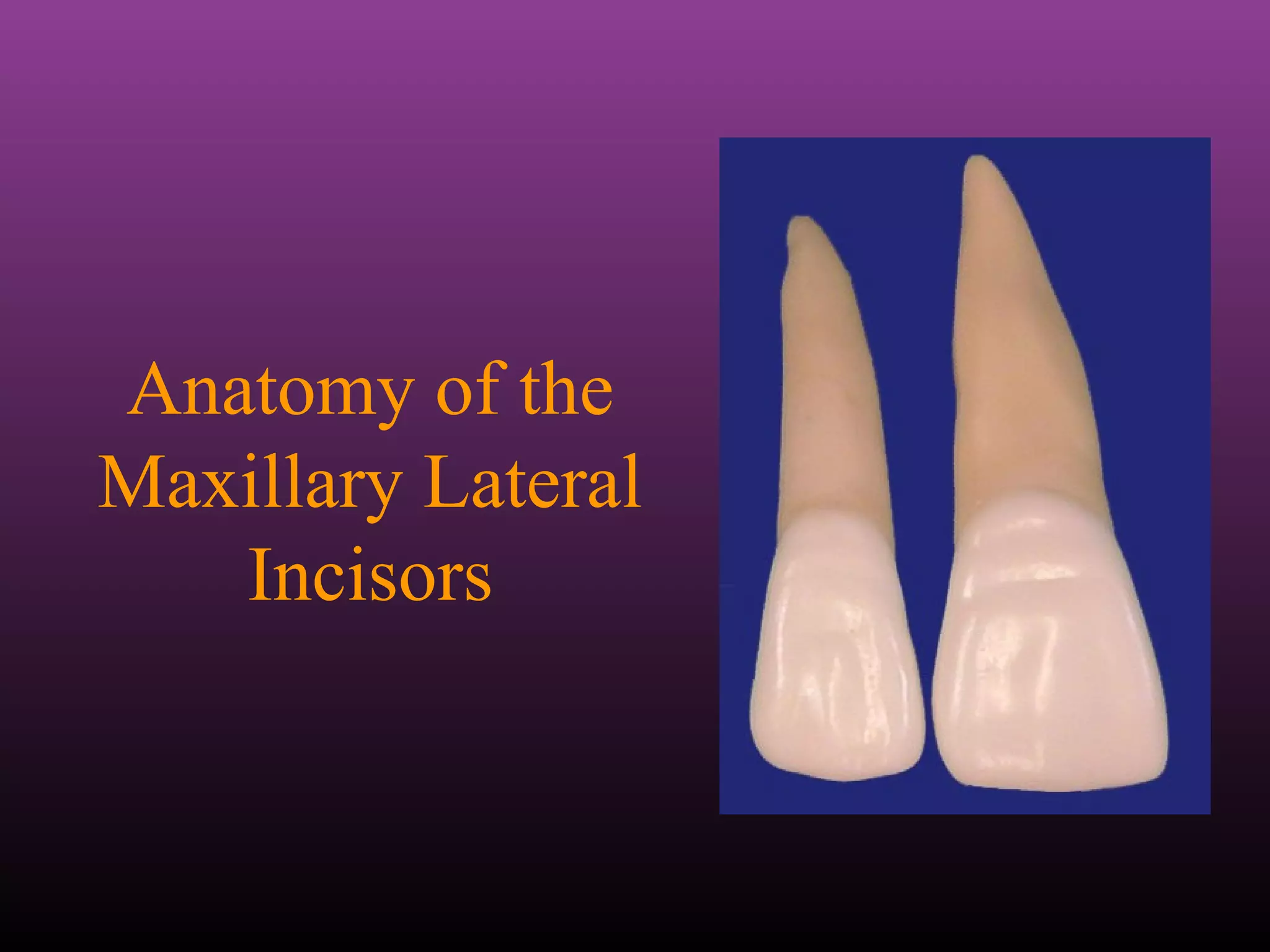 Maxillary Lateral and Mandibular Incisors | PPT