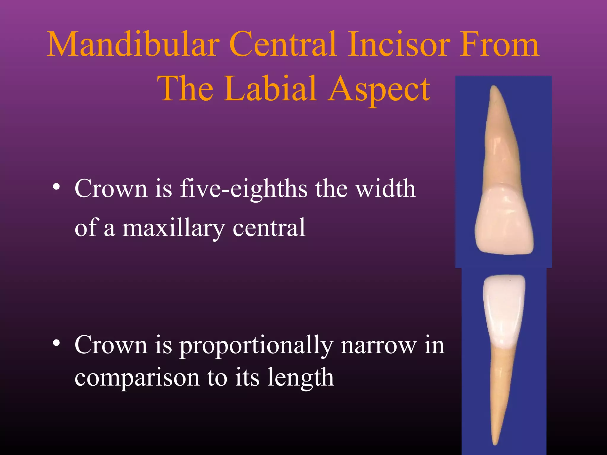 Maxillary Lateral and Mandibular Incisors | PPT
