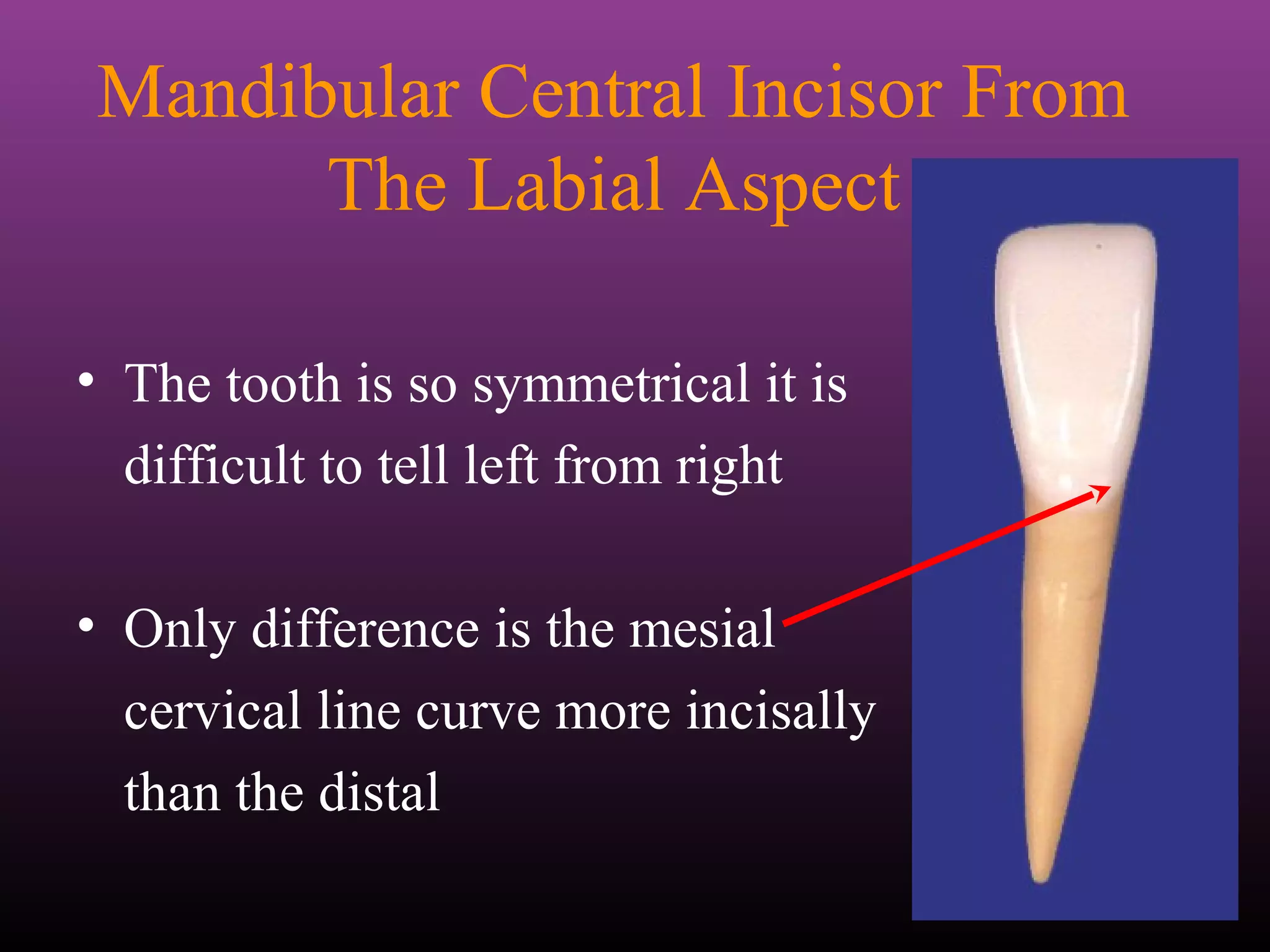 Maxillary Lateral and Mandibular Incisors | PPT