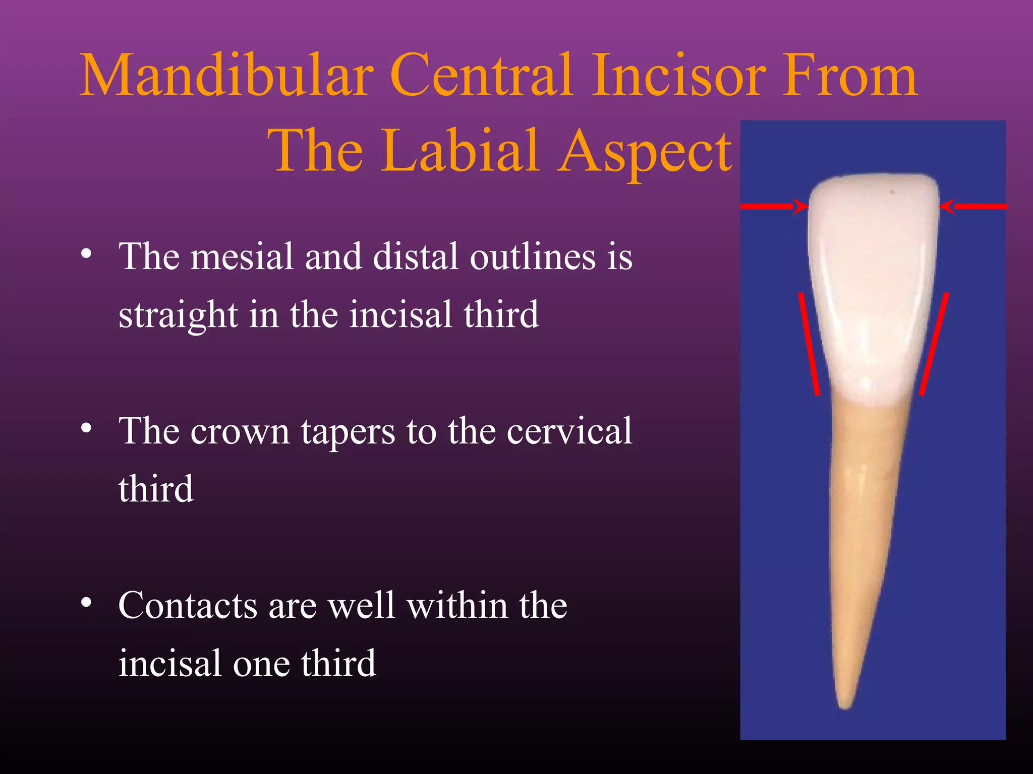 Maxillary Lateral and Mandibular Incisors | PPT
