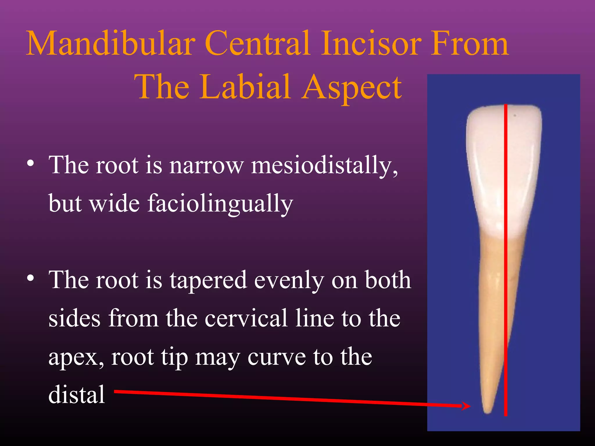 Maxillary Lateral and Mandibular Incisors | PPT
