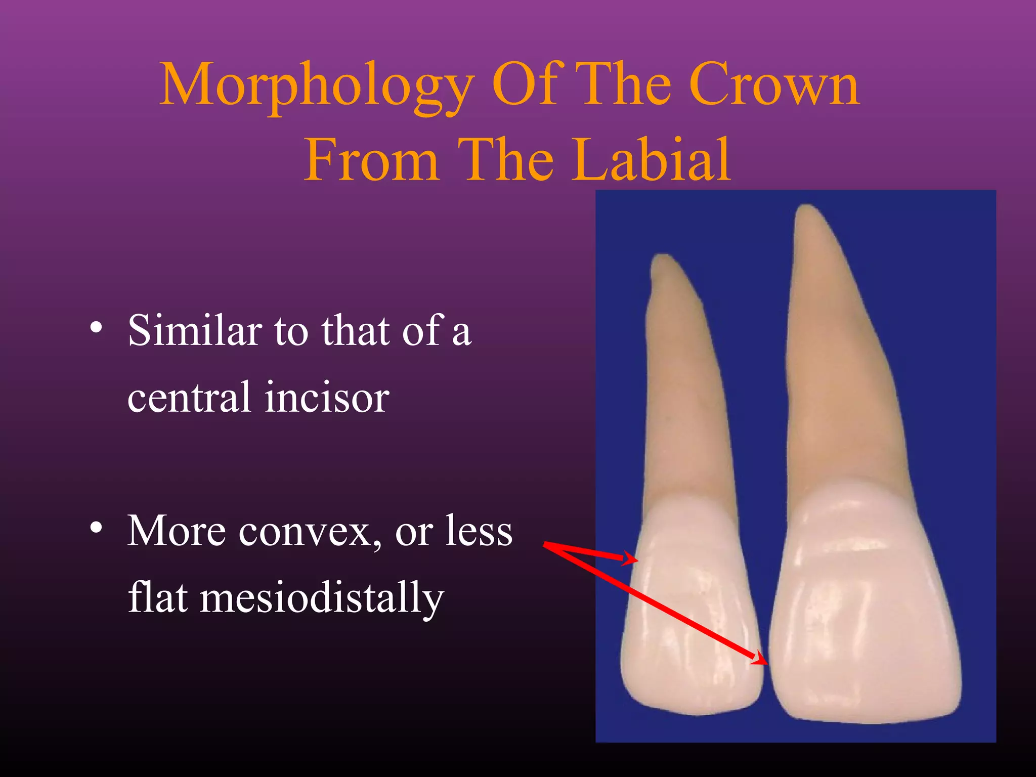 Maxillary Lateral and Mandibular Incisors | PPT