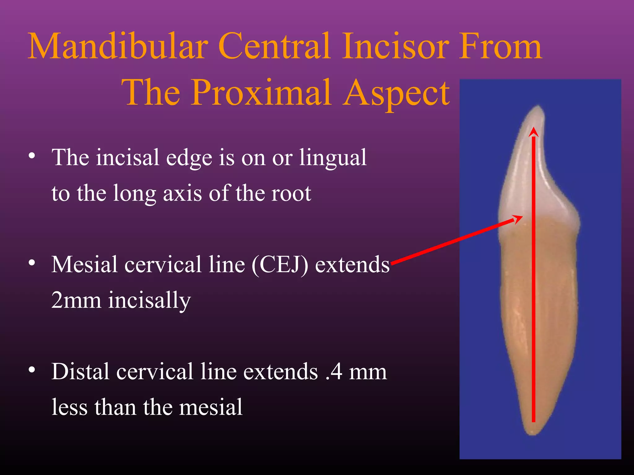 Maxillary Lateral and Mandibular Incisors | PPT