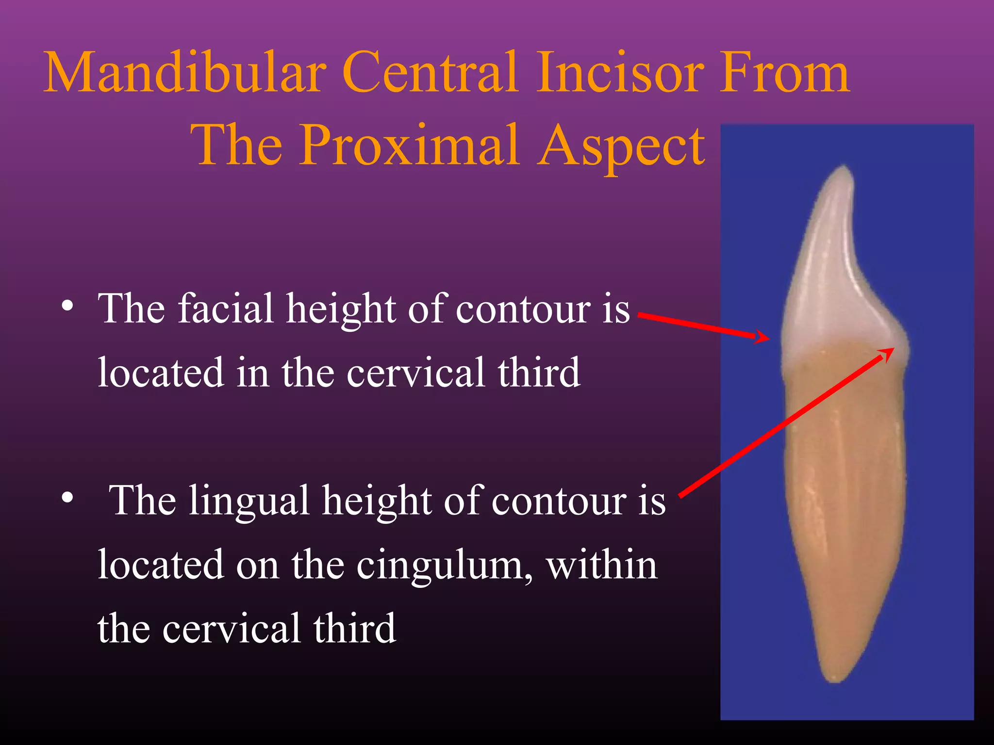 Maxillary Lateral and Mandibular Incisors | PPT