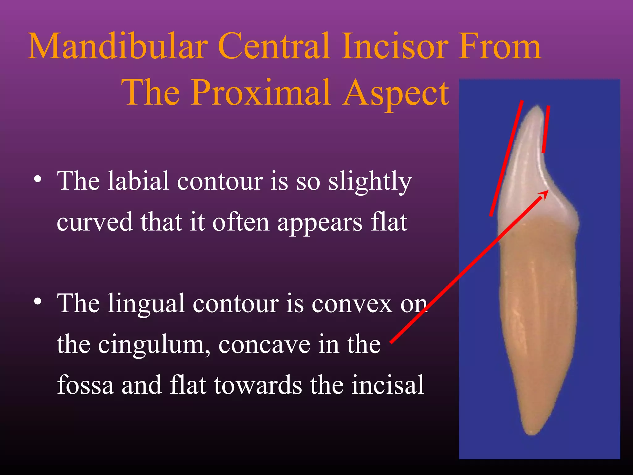 Maxillary Lateral and Mandibular Incisors | PPT