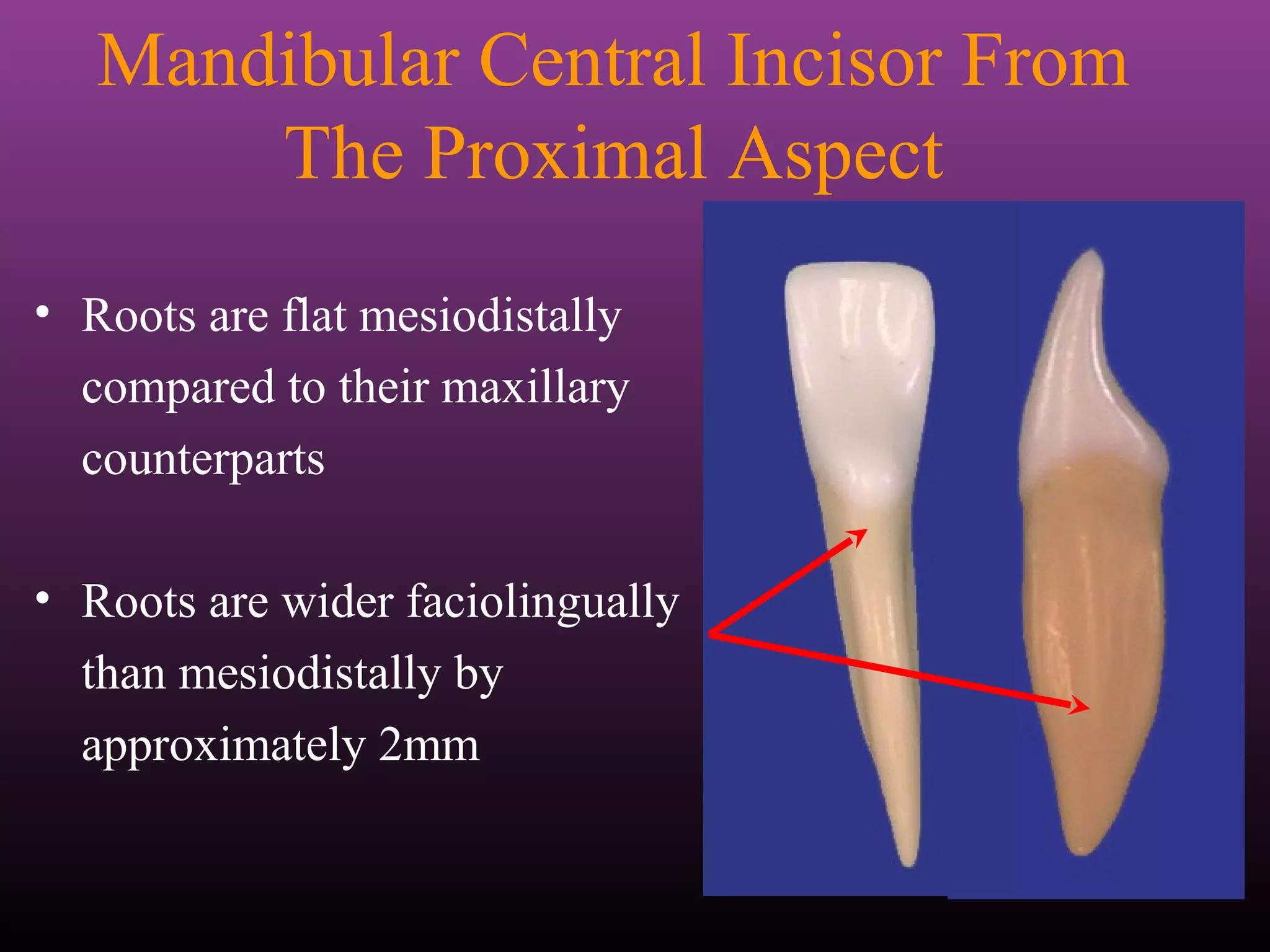 Maxillary Lateral and Mandibular Incisors | PPT